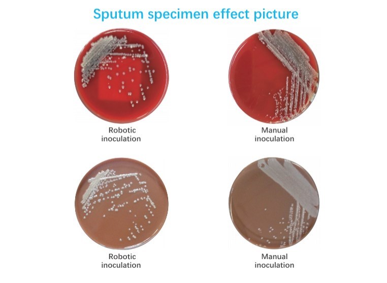 Microbial sample pretreatment system