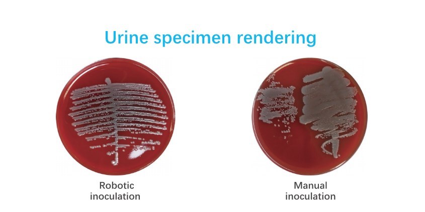Microbial sample pretreatment system