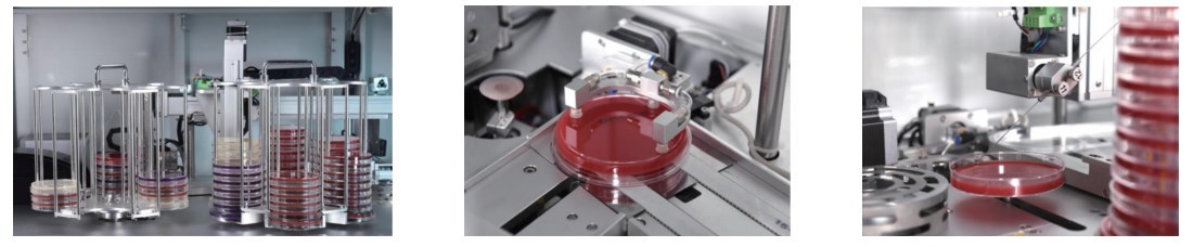 Microbial sample pretreatment system